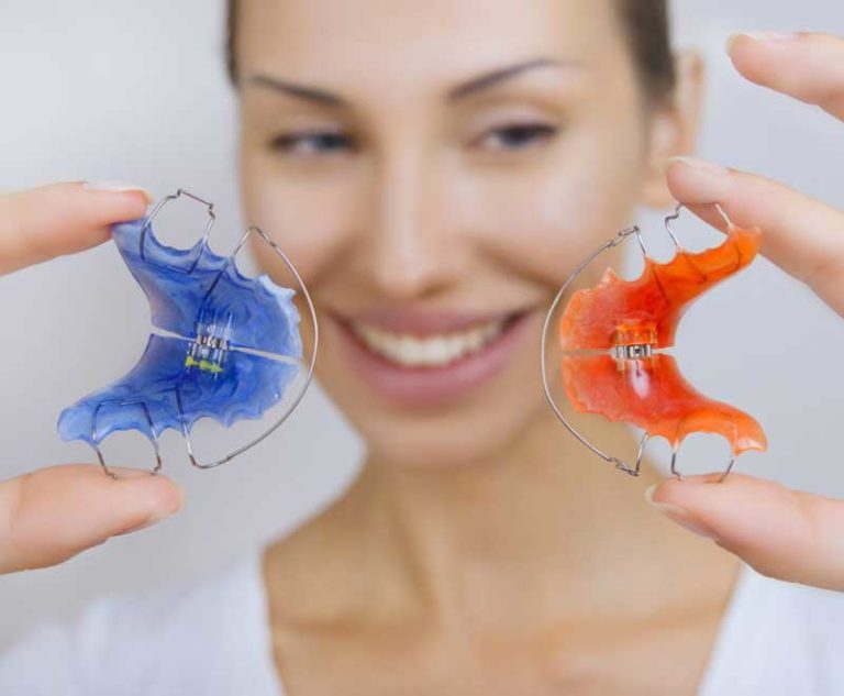 Removable Braces - Quayside Orthodontics