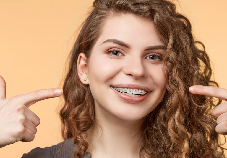Ceramic Braces Quayside Orthodontics